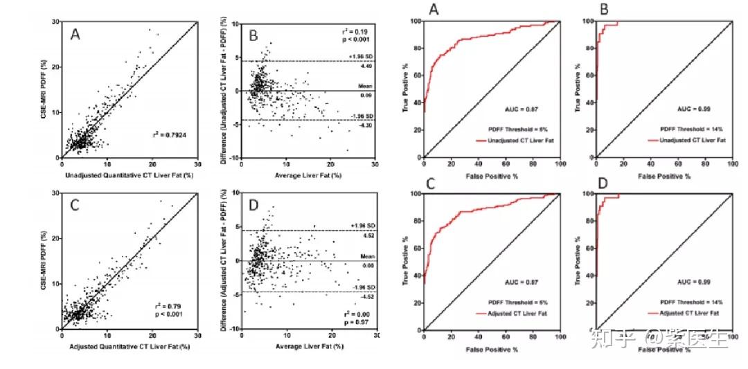 定量CT（QCT）是什么？临床应用有哪些？ - 知乎