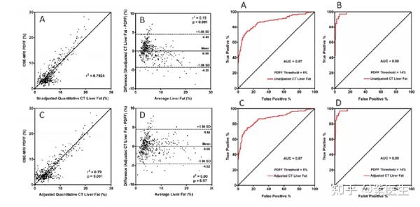 定量CT（QCT）是什么？临床应用有哪些？ - 知乎