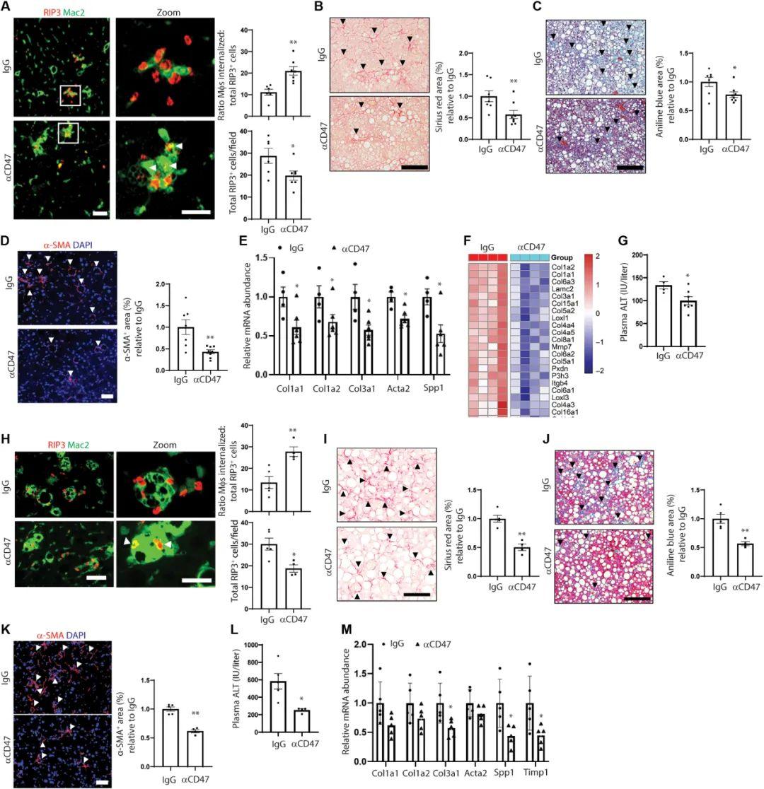 Sci Tra Med | 肝巨噬细胞清除肝炎中坏死肝细胞、减少肝纤维化 - 知乎