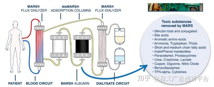 国内国外大不同？一文看懂非生物型人工肝国内外技术路线 - 知乎