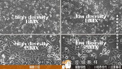 NCI-H1299细胞培养，人非小细胞肺癌细胞培养攻略 - 丰晖生物 - 知乎