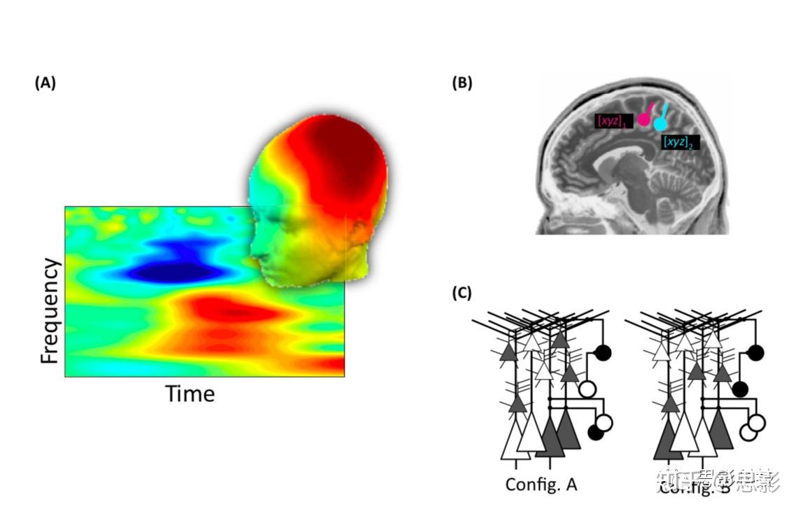 Where Does EEG Come From and What Does It Mean? - 知乎