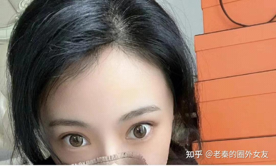 白发显老,怎么才能有效改善白头发? 知乎