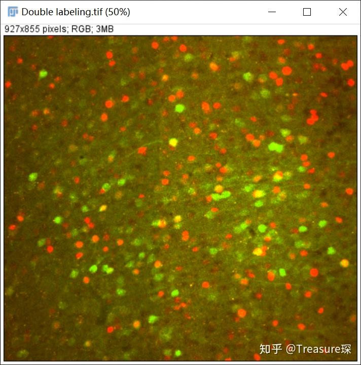 ImageJ实用技巧——荧光共标细胞计数(解放双手篇) - 知乎