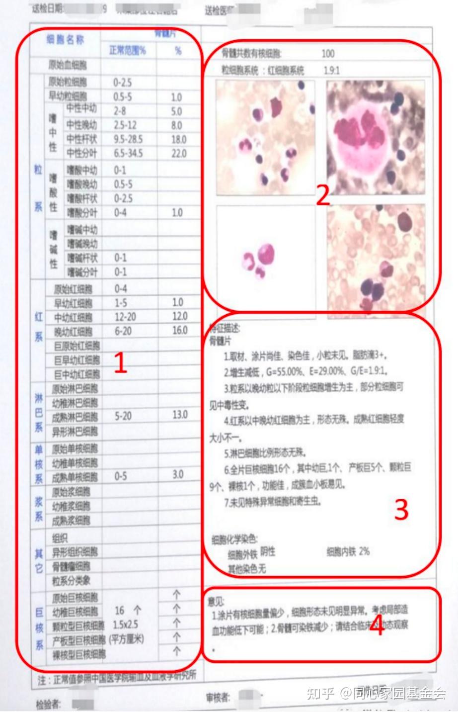 这样看骨穿报告，医生懂得您也懂 知乎