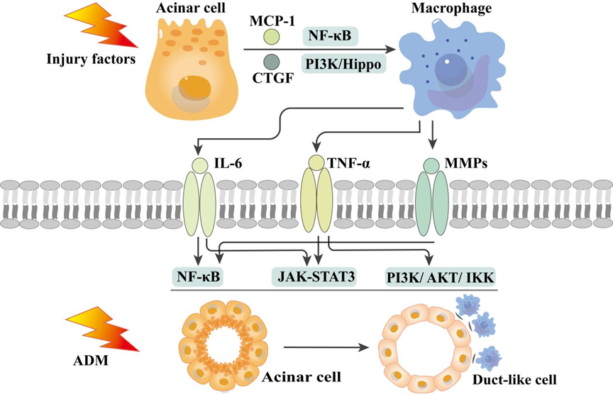 Pharmacol Res 综述︱项红等评述巨噬细胞：慢性胰腺炎免疫治疗领域一颗冉冉升起的新星 - 知乎