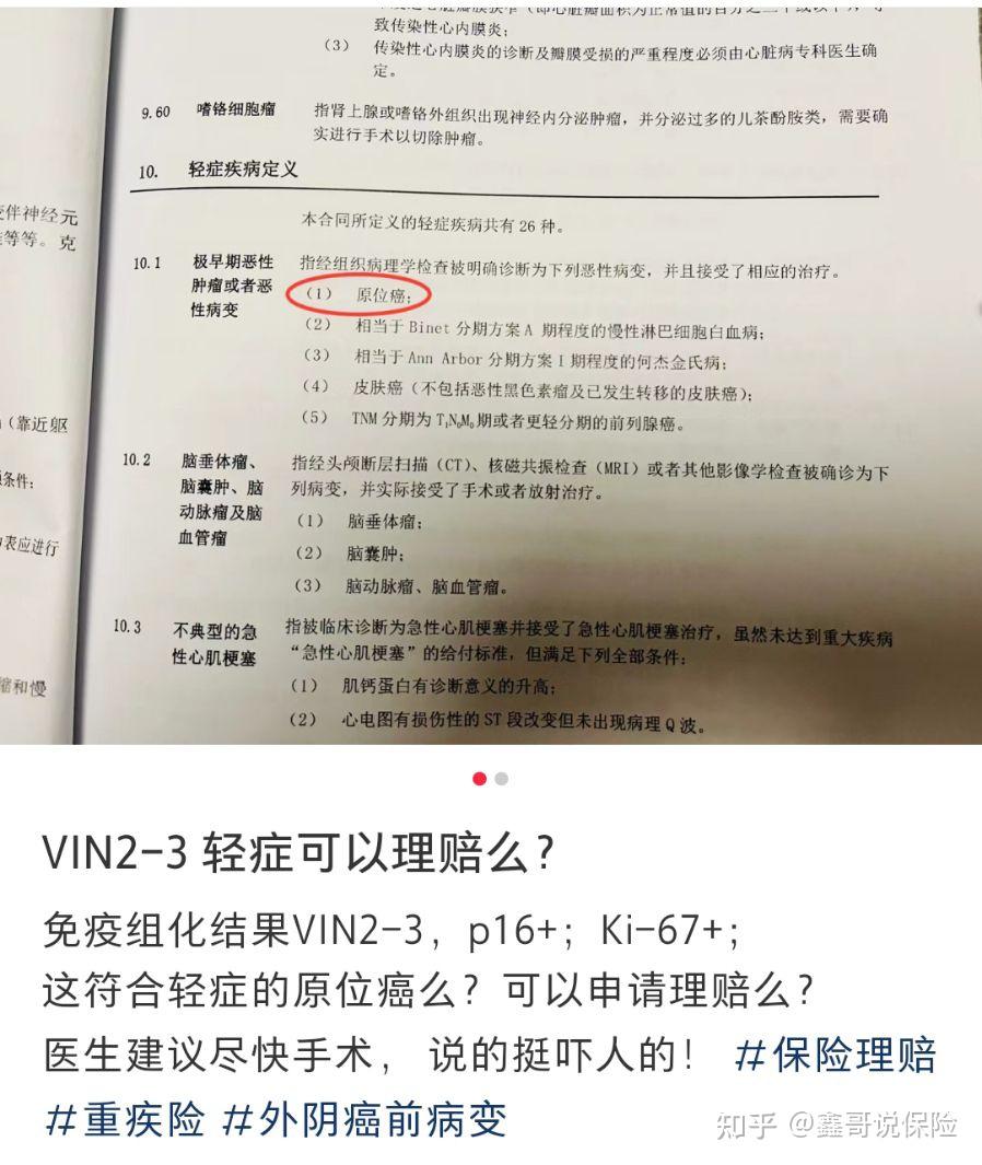 外阴上皮内瘤病VIN2-3级可以按轻症理赔？ - 知乎