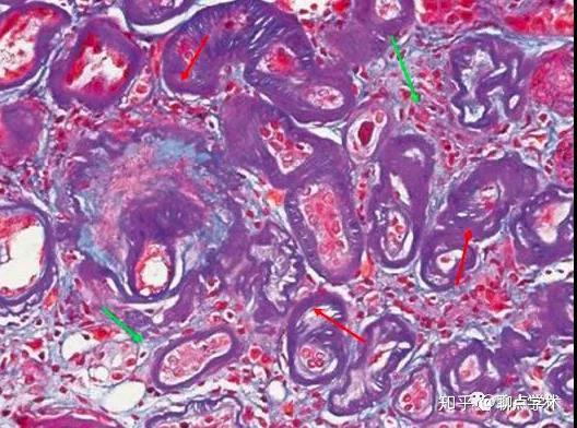 【干货】大鼠肾间质纤维化模型（UUO法） - 知乎