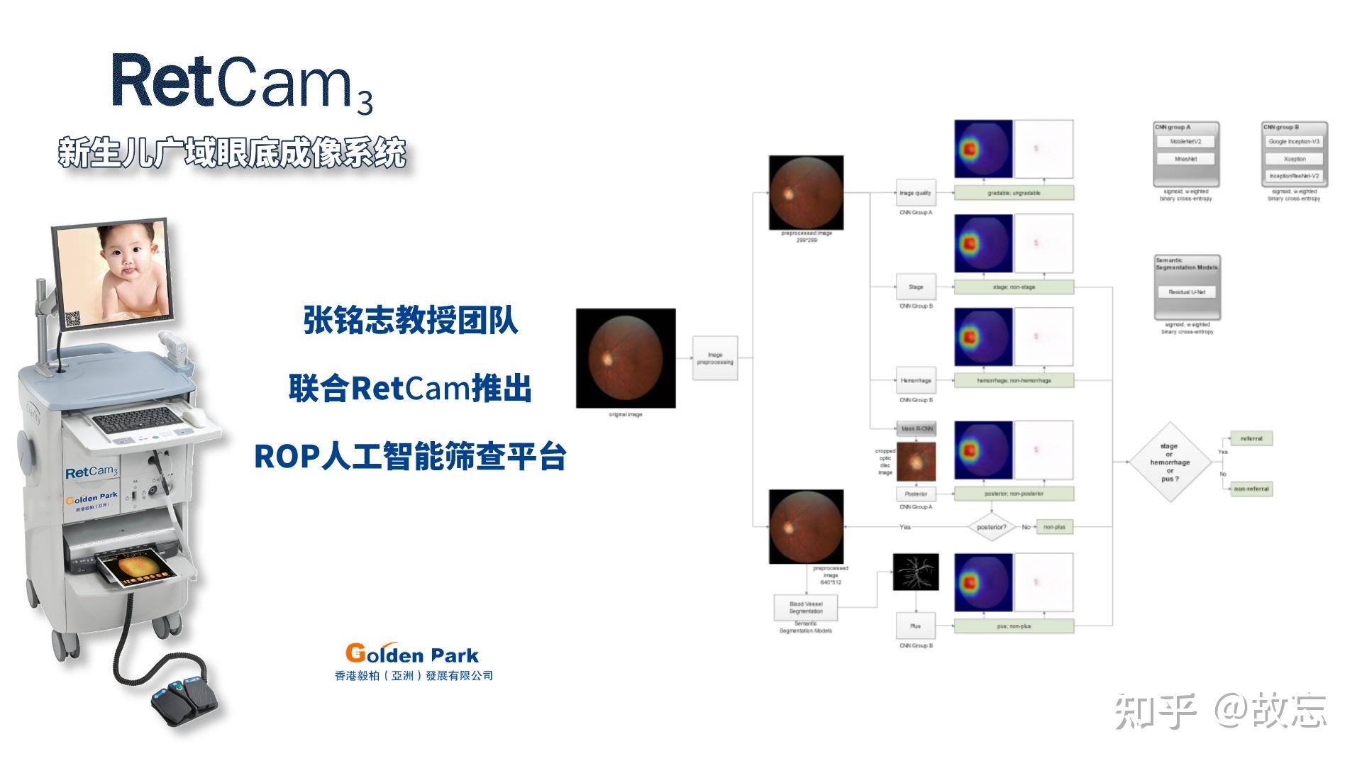 世界首发具备AI系统的新生儿眼底筛查系统——RetCam - 知乎