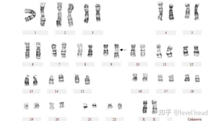 染色体多态性和数目变异 - 知乎