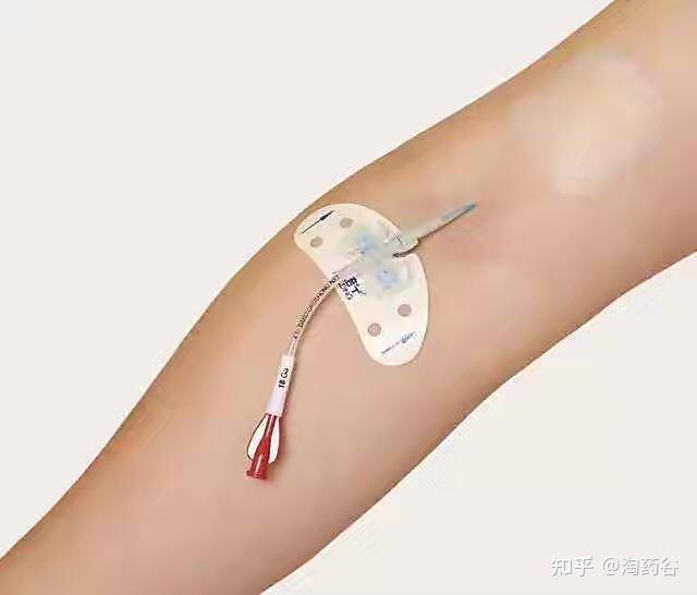 化疗时，医生为什么建议使用PICC？ - 知乎