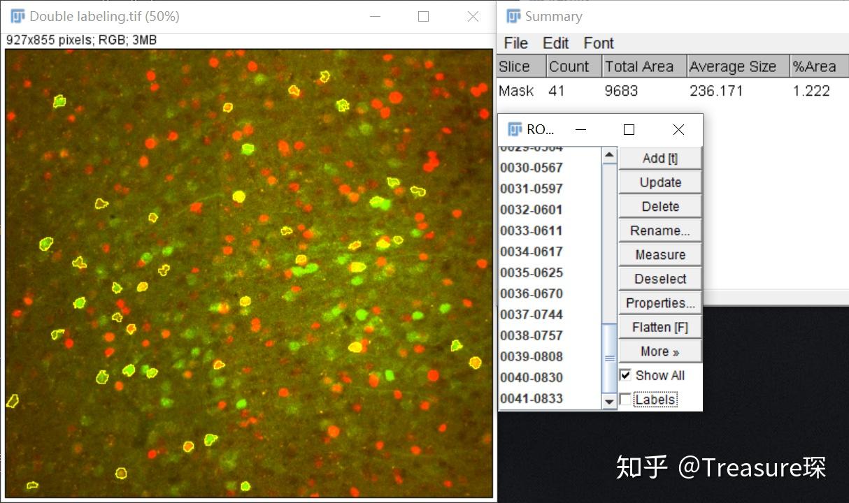ImageJ实用技巧——荧光共标细胞计数(解放双手篇) - 知乎