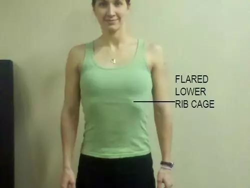 什么是肋骨外翻？应该如何改善？ - 知乎