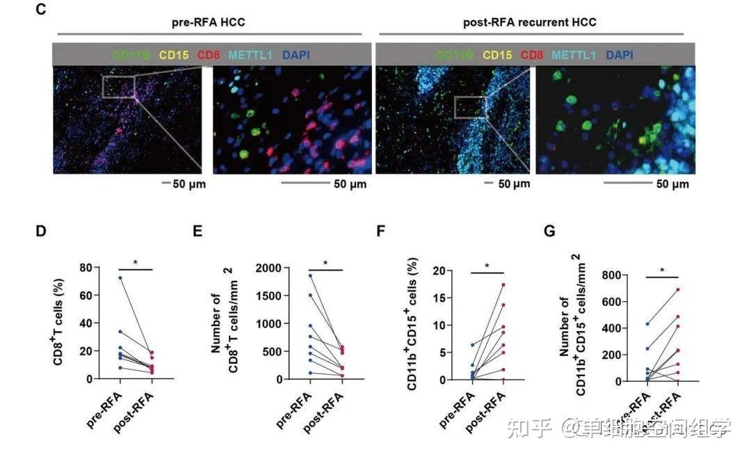 TissueFAXS Cytometry肿瘤免疫方向经典文章分享 - 知乎