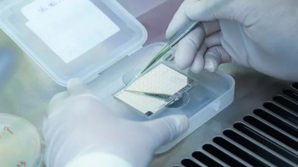 鉴“微”知“株”丨MALDI-TOF MS，几分钟完成菌种“身份识别” - 知乎