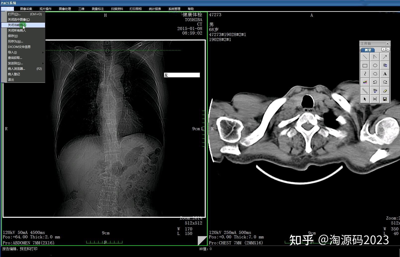 医学影像系统源码（MRI、CT三维重建） - 知乎
