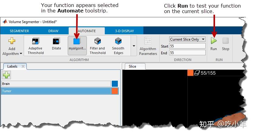 MATLAB图像处理：90：使用 Volume Segmenter 创建二进制蒙版 - 知乎