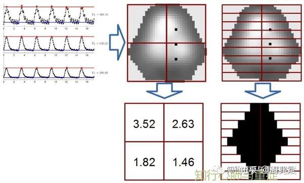 第139期胸部电阻抗断层成像（EIT）的原理、图像分析及临床应用 - 知乎
