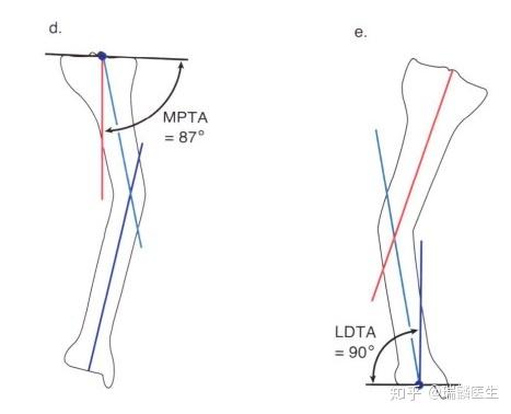 《矫形外科原则》读书笔记（二）-胫骨机械轴及解剖轴分析 - 知乎