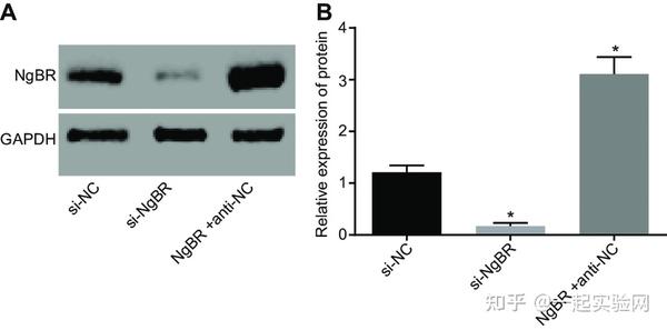 解读文献里的那些图——Western blot - 知乎