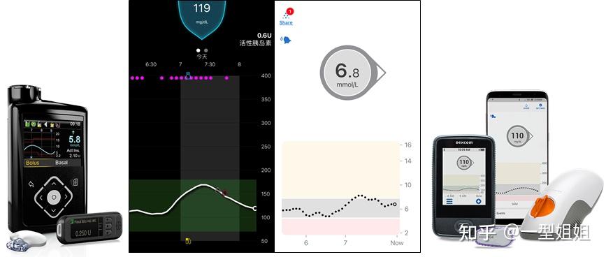 那些年，用过的动态血糖（CGM）系统 - 知乎