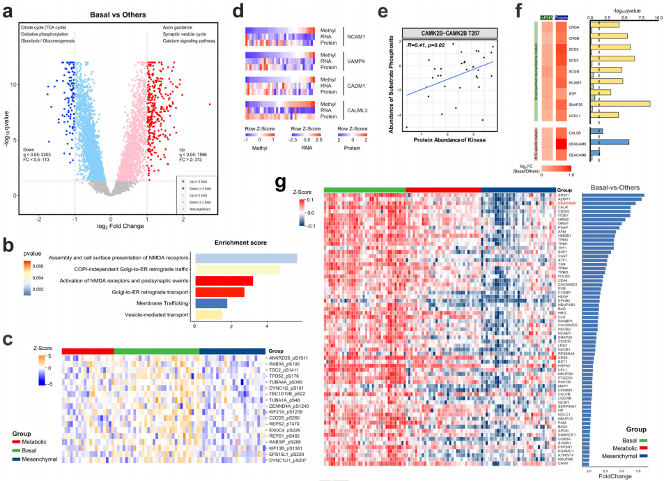Cell Discovery | 蛋白基因组学揭示甲状腺髓样癌分型及治疗靶标 - 知乎