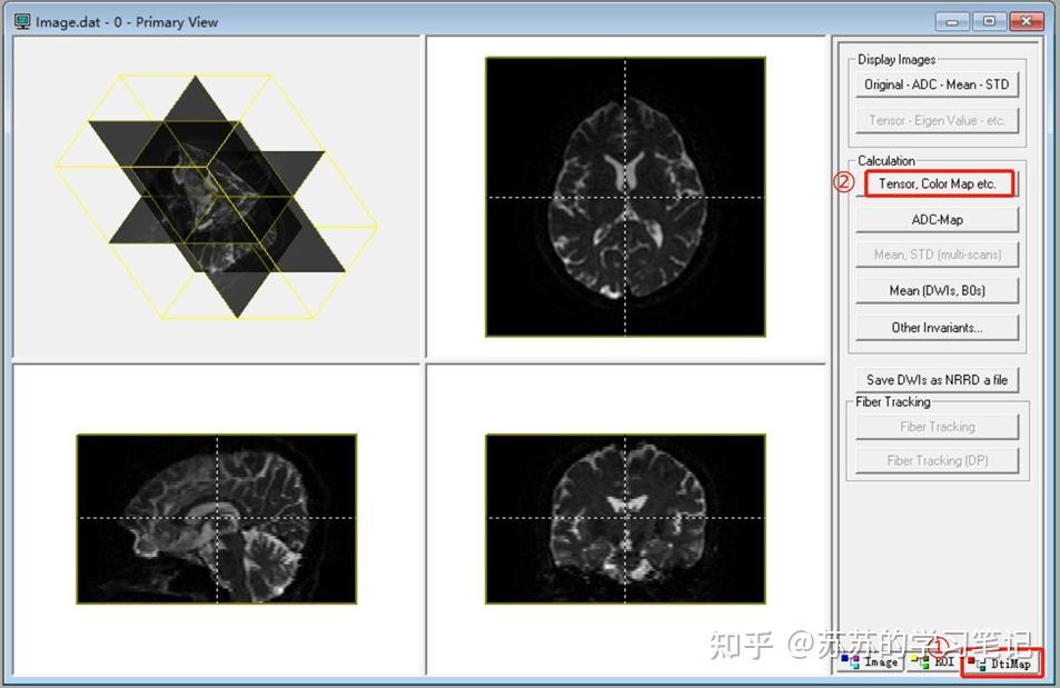 DTI Studio操作教程 - 知乎