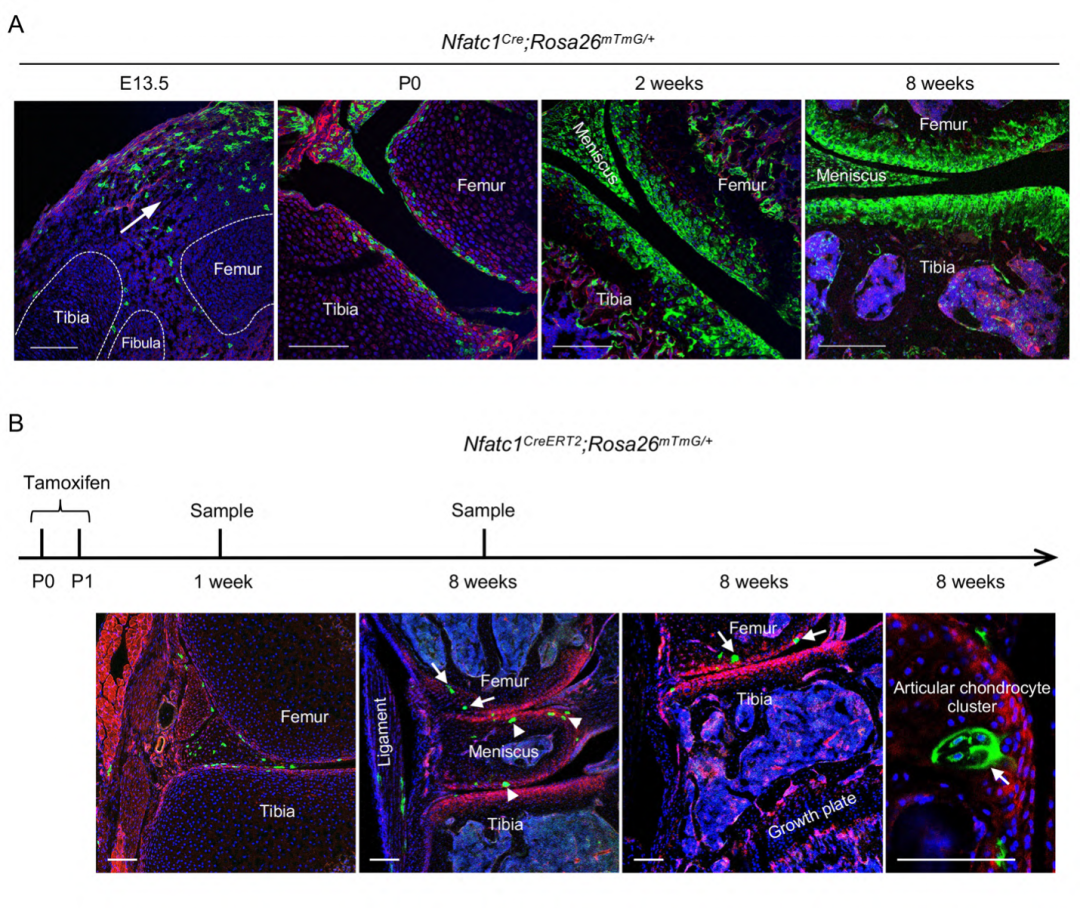 eLife︱首医宣武医院葛献鹏团队发现NFATc1是调控关节软骨干细胞分化的关键基因 - 知乎