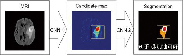Deep Learning for Brain MRI Segmentation: State of the Art and Future ...