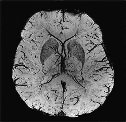 重大突破！临床磁共振进入7T时代！ - 知乎