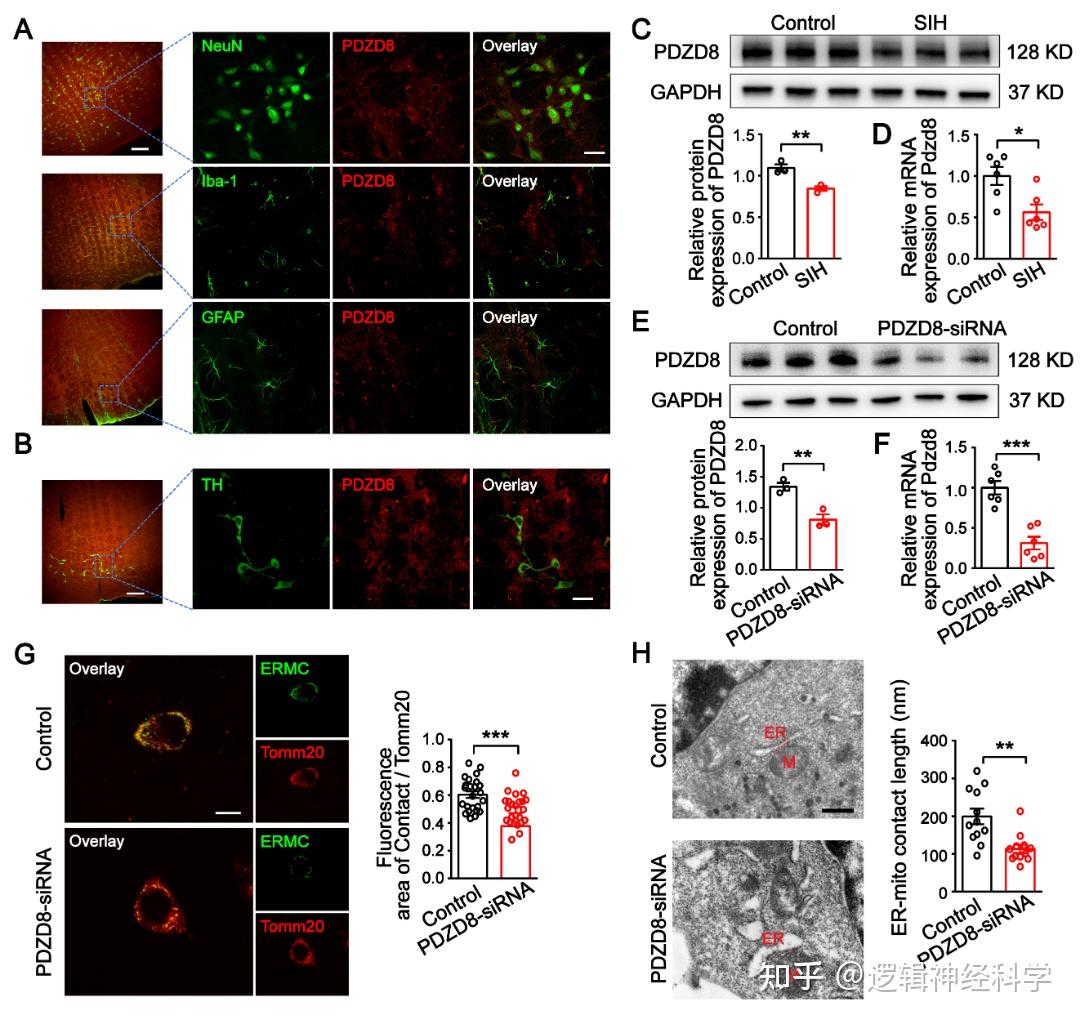 Neurobiol Dis︱上海大学杜东书/张帅团队揭示PDZD8介导RVLM神经元内质网线粒体互作对应激性高血压作用 - 知乎