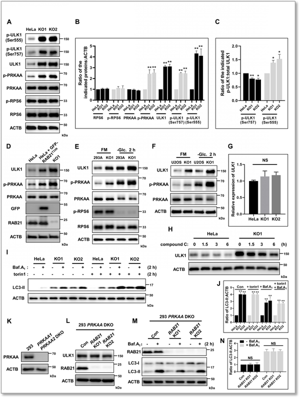 Autophagy︱华中科技大学张新军课题组揭示了RAB21在调控retromer介导的逆向回膜转运以及维持细胞能量稳态中的重要作用 - 知乎