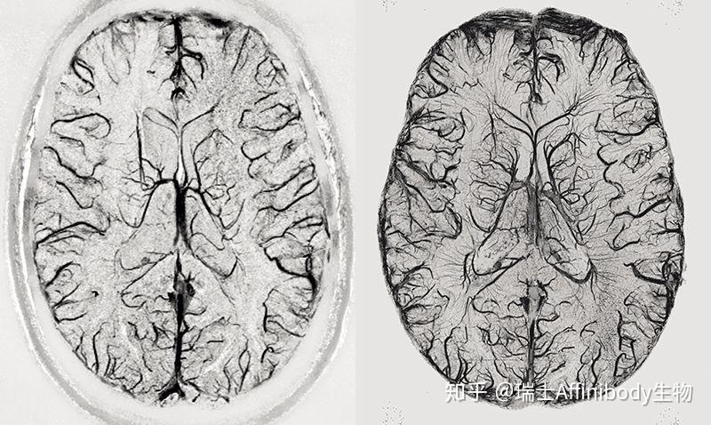 超高分辨率MRI脑图像 - 知乎