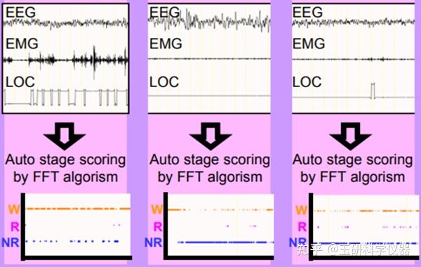 SleepSign 睡眠分析系统 - 知乎