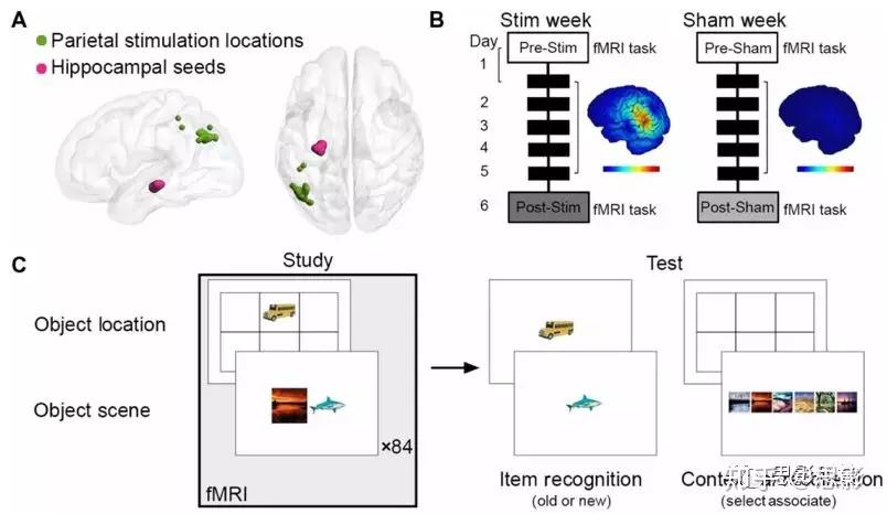 任务态fMRI研究：TMS刺激选择性改变情景记忆网络的功能 - 知乎