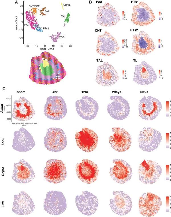 文献解读：急性肾损伤小鼠空间转录组测序分析 - 知乎