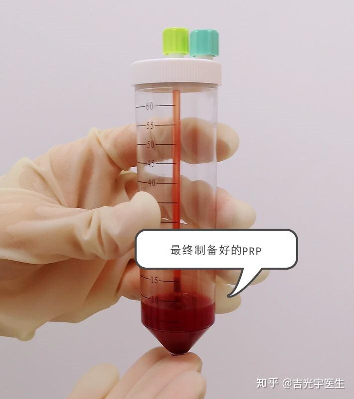 PPP，PRP、PRF都是什么，有什么区别？ - 知乎