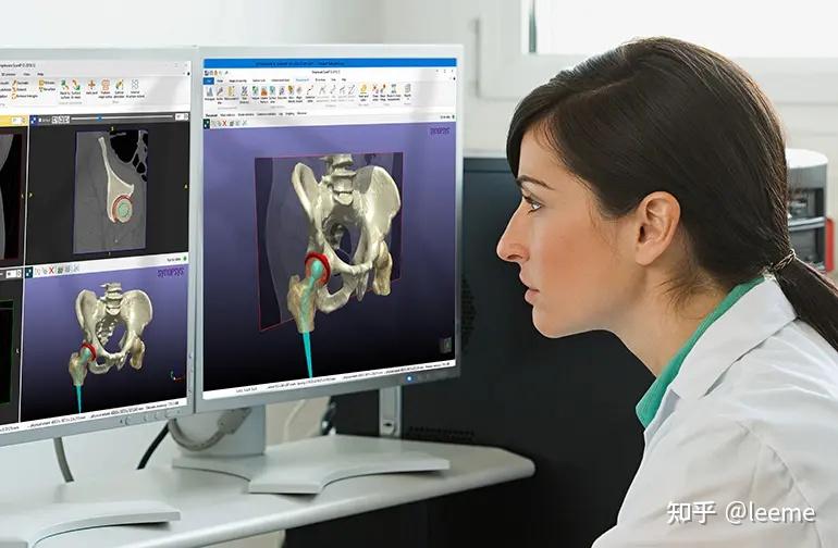 世界著名医疗影像软件介绍 - 知乎