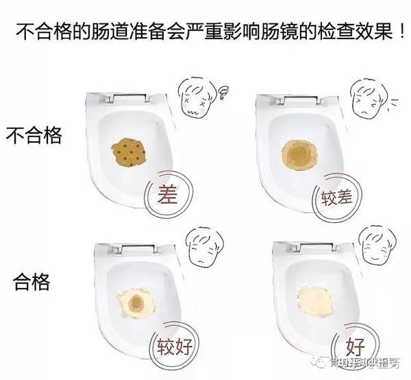 做肠镜,清肠不合格,白遭罪!!!——图示肠镜检查全过程 知乎