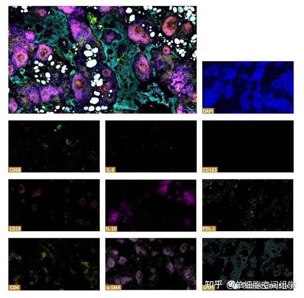 2月28日webinar预告| TSA染色技术解析与肿瘤免疫Panel组合推荐 - 知乎