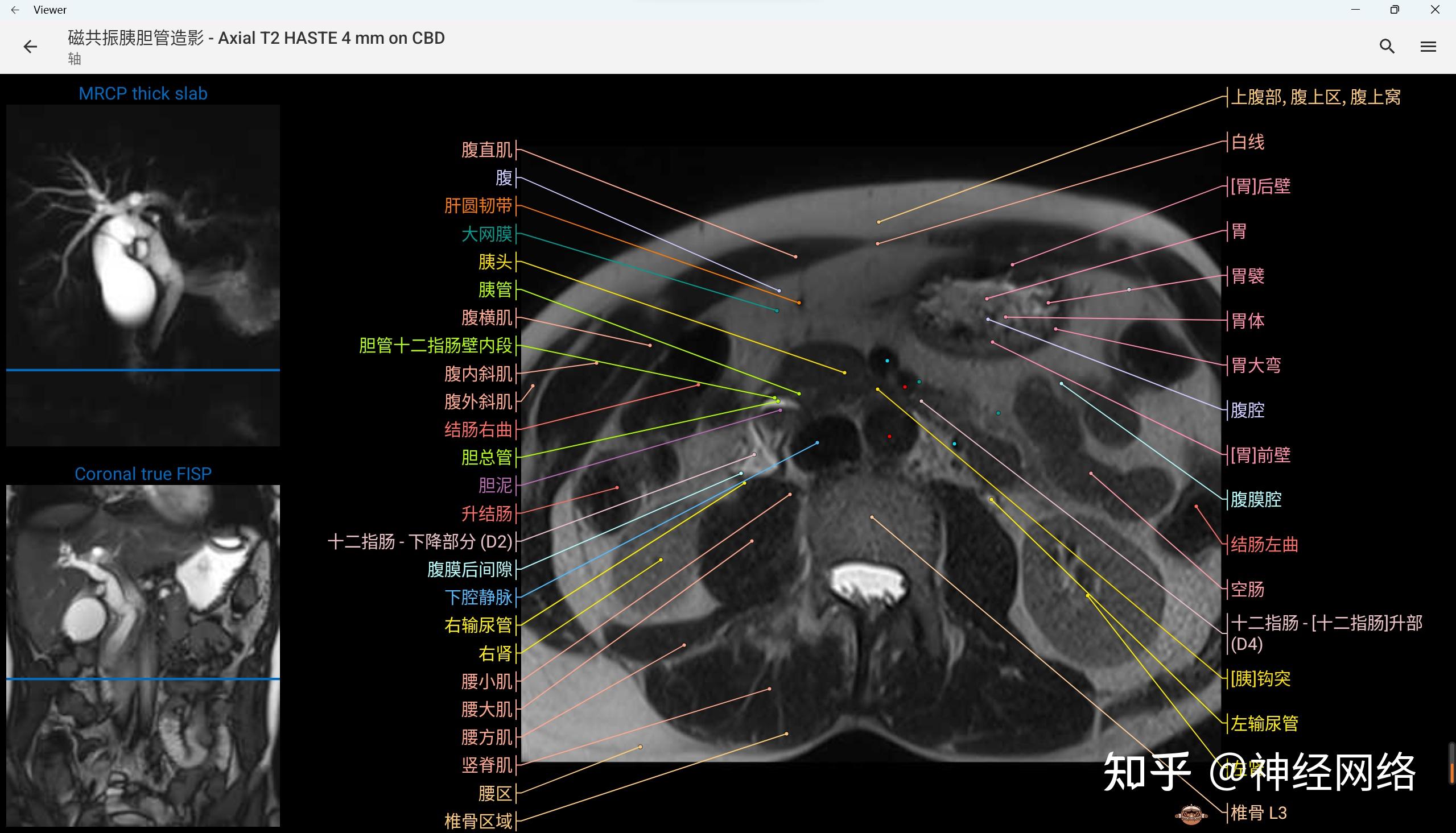 推荐一款超实用的影像软件工具 e-Anatomy（支持安卓、win11及Mac设备） - 知乎