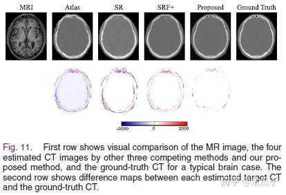 不同模态MRI医学图像合成 - 知乎