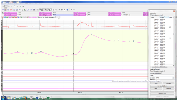 AcqKnowledge软件进行皮肤电反应（EDA/SCR）分析的详细教程 - 知乎