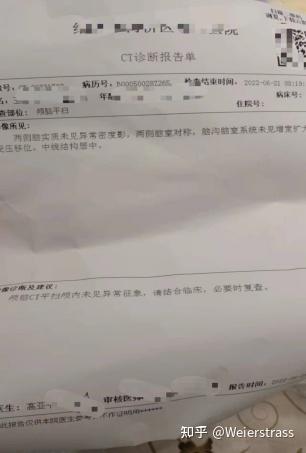 我的ICL晶体植入与取出过程 - 知乎