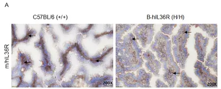罕见型银屑病治疗新时代，靶向IL-36R研究已就位 - 知乎