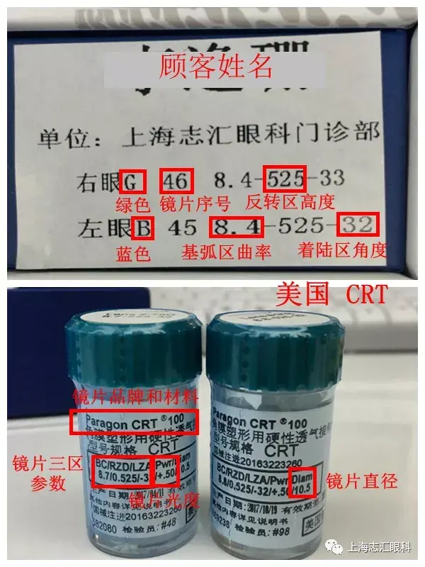 独家！全方位揭秘OK镜 - 知乎
