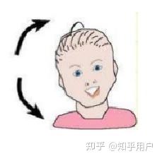 主动脉狭窄和关闭不全 Aortic valve stenosis and regurgitation - 知乎