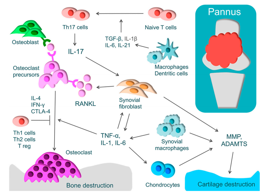 不死的癌症--RA/CIA关节炎模型治疗新进展 - 知乎