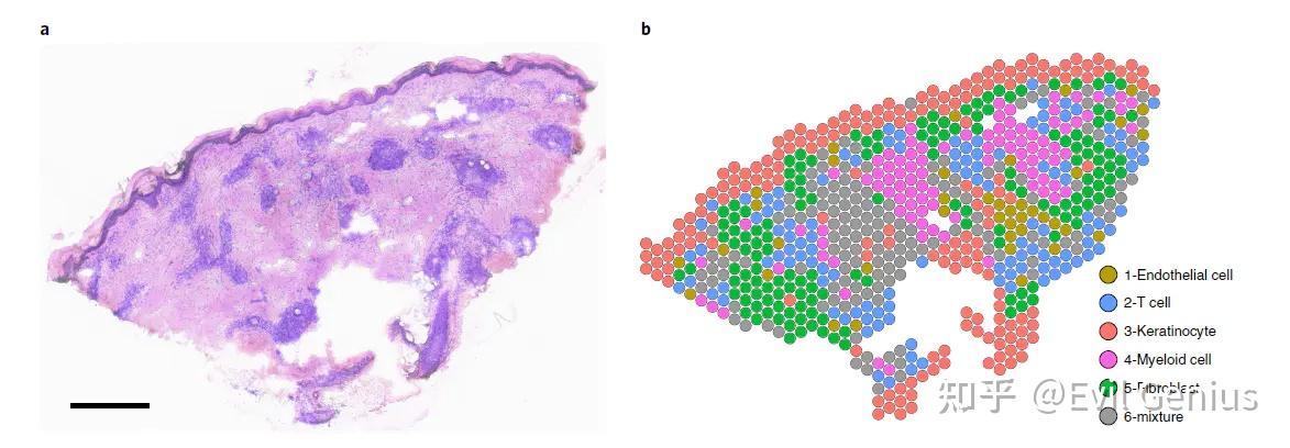 单细胞空间联合分析方法之文献运用篇 - 知乎