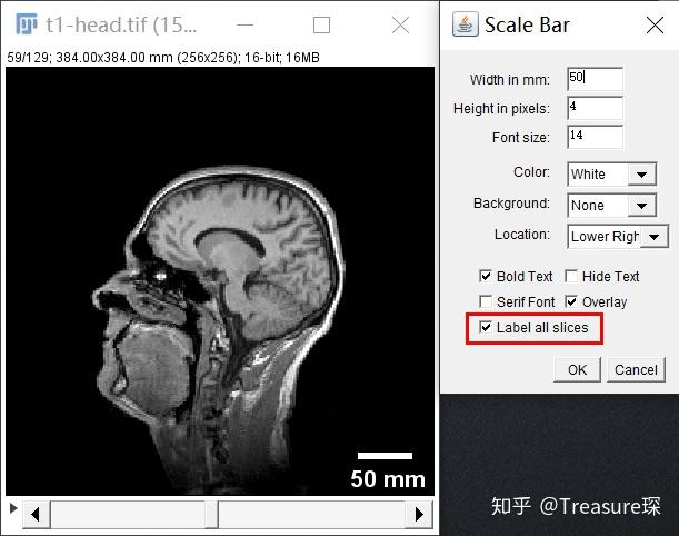 ImageJ实用技巧——比例尺设置和批量添加(基本功能篇) - 知乎